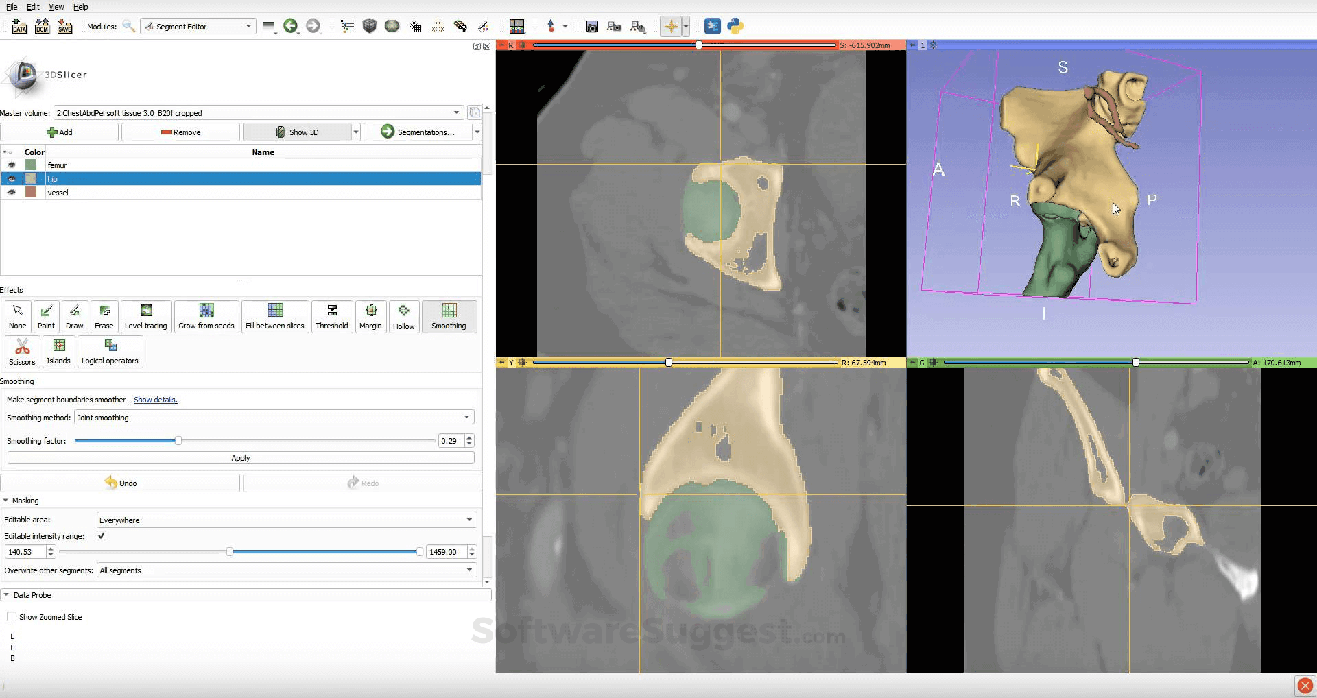 3D Slicer - Pricing, Features, and Details in 2026