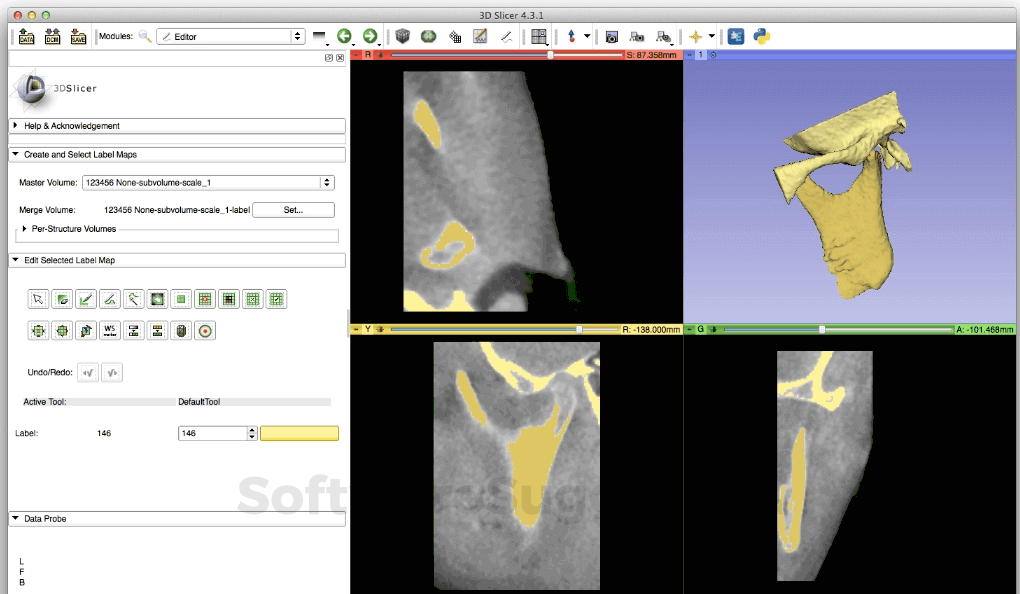 3D Slicer - Pricing, Features, and Details in 2025