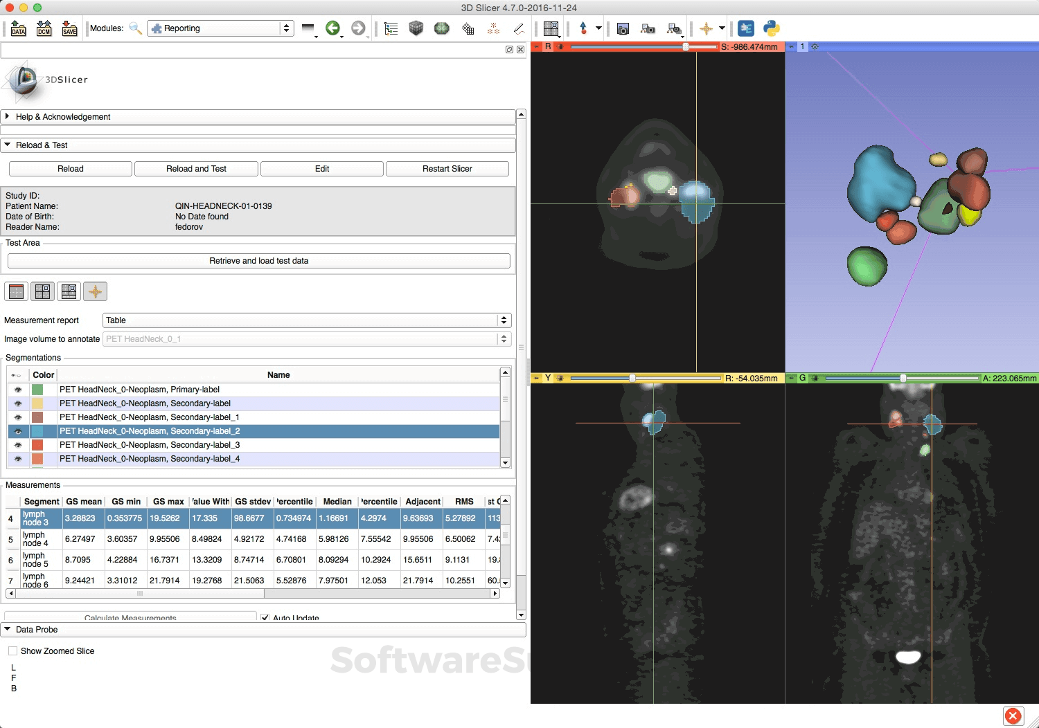 3D Slicer - Pricing, Features, and Details in 2025
